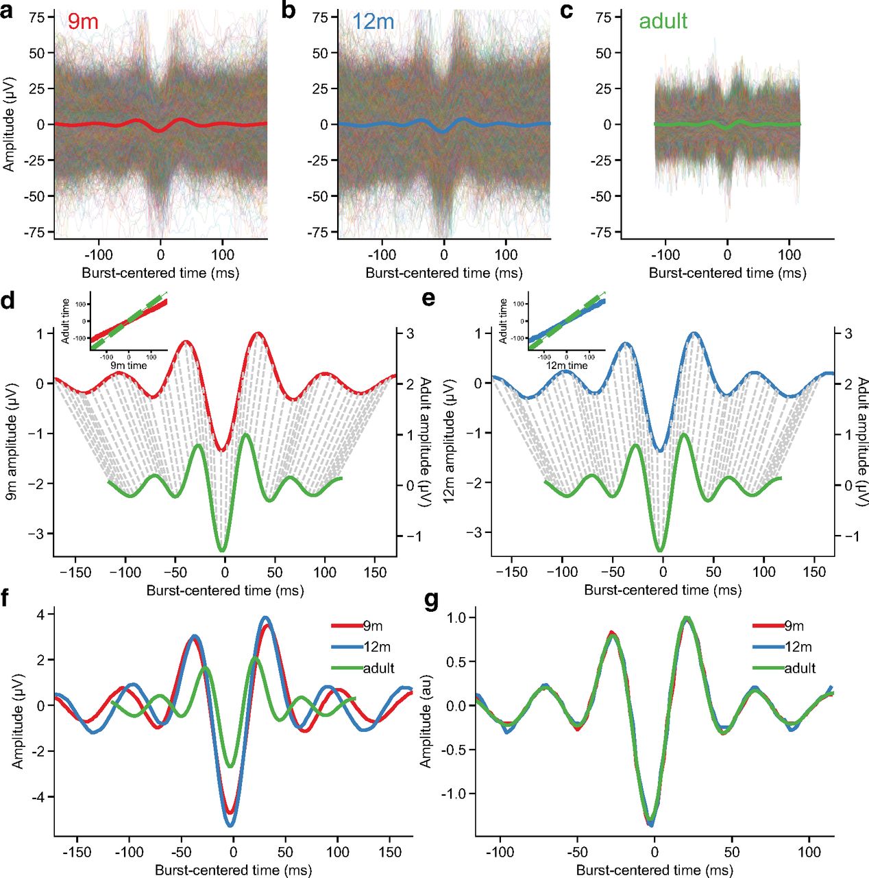 Bursting with Potential: How Sensorimotor Beta Bursts Develop from ...