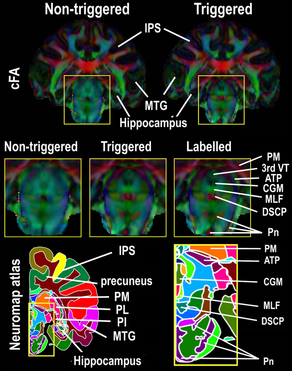 Cardiovascular effects on high-resolution 3D multi-shot diffusion MRI ...